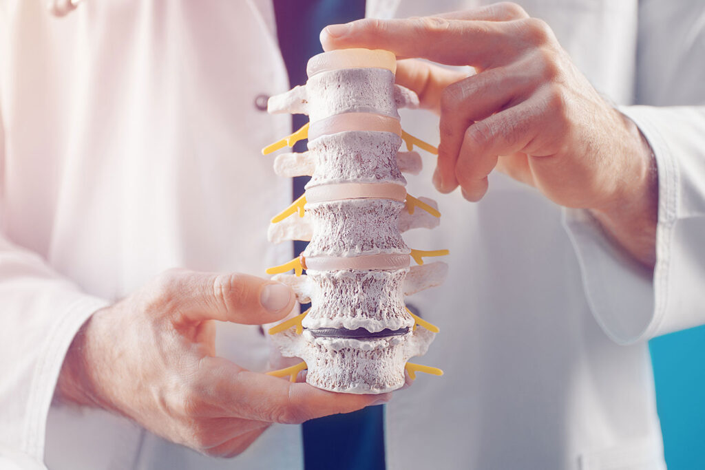 Vertebrobasilar Insufficiency (VBI): Causes, Symptoms, Diagnosis and ...